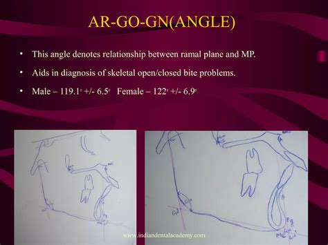 Cogs Analysis Cephelometrics For Orthognathic Surgery Fixed Cogs Analysis Cephelometrics For Orthognathic Surgery Fixed