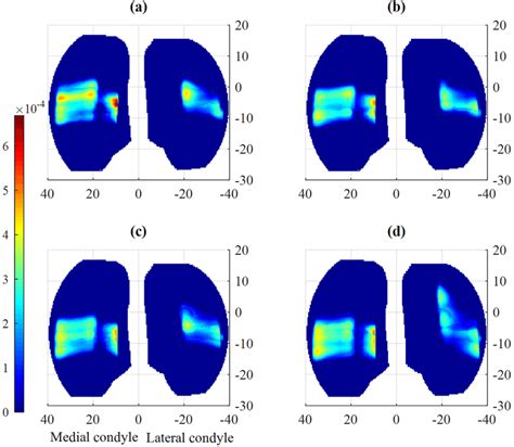 Effect Of Static And Dynamic Friction Coefficients On The Damage Of