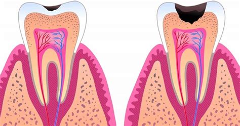 Шүд хорхойтох Эмийн ургамал судлалын төв