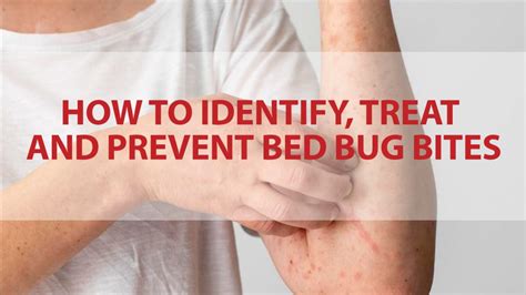 How To Identify Treat And Prevent Bed Bug Bites