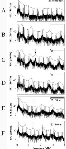 spectra and linear predictive coding lpc envelopes for different download scientific diagram