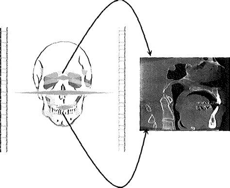 Figure 3 From A Clinical Evaluation Of Cone Beam Computed Tomography Semantic Scholar