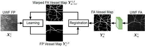 Deep Retinal Vessel Segmentation For Ultra Widefield Fundus Photography