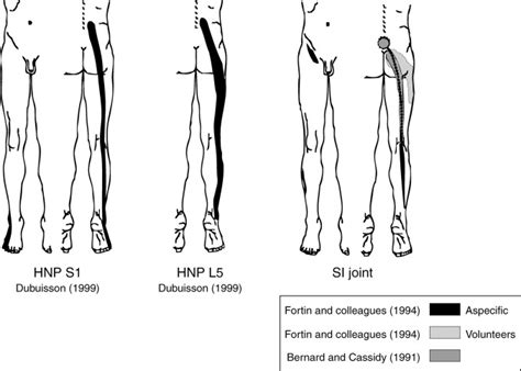 Si Joint Pain Referral Patterns