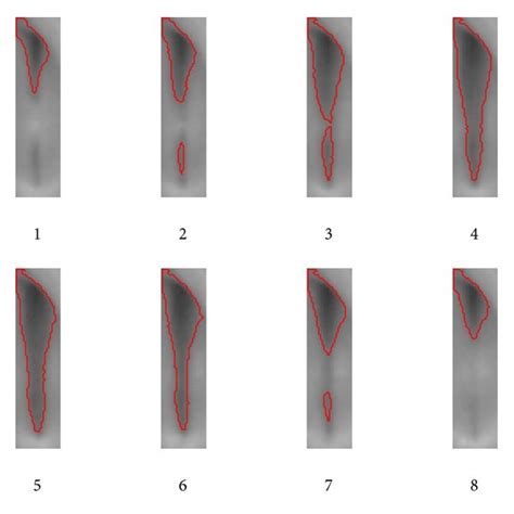 Case 3 Segmented Hsv Image Sequence By The Method Of 7 A The Download Scientific Diagram