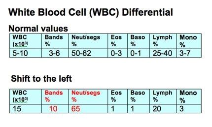 What Is A Shift To The Left In Blood Testing EHow