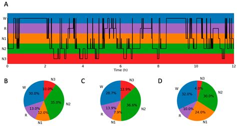Get A New Perspective On Eeg Convolutional Neural Network Encoders For Parametric T Sne