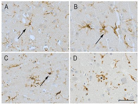Illustration Of The Different Morphologies Adopted By Microglia In The Download Scientific