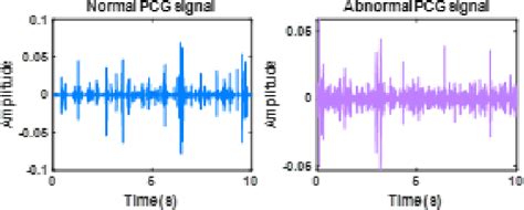Figure 2 From Classification Of Cardiovascular Disease Using 2d Image Representations Of