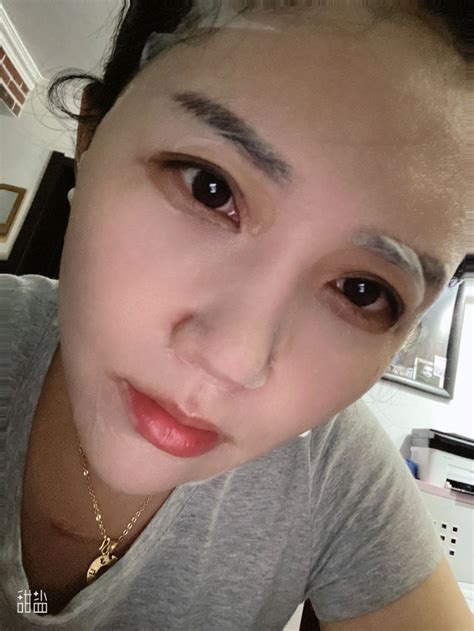超声炮的效果好吗，超声炮做了几天才恢复 哔哩哔哩