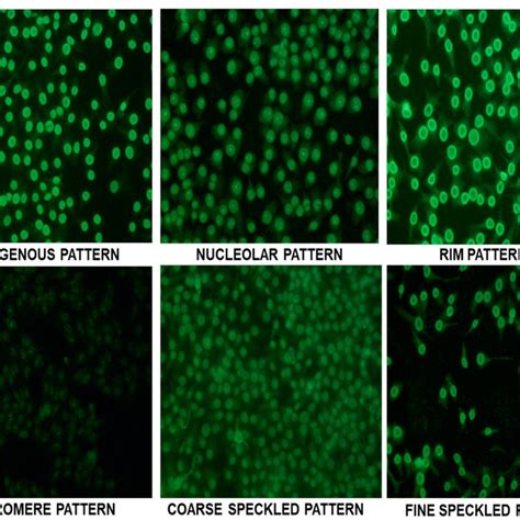 Common Ana Patterns On In House Hep 2 Cell Slides Download Scientific Diagram