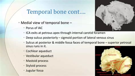 Anatomy Temporal Bone Pdf