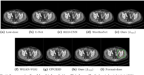 Figure 2 From Wavelet Subband Specific Learning For Low Dose Computed