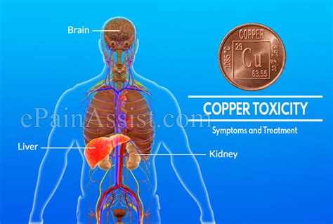 Copper Toxicity Symptoms And Treatment