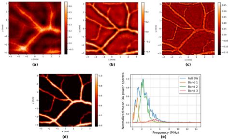 Reconstruction Example Of The Proposed Method Using N 3 A C Low Download Scientific