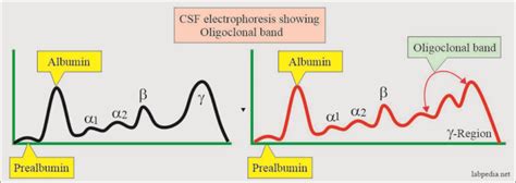 Cerebrospinal Fluid Analysis Part 2 CSF Examination Normal Abnormal CSF Interpretations