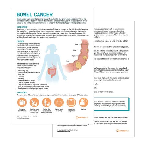 Bowel Cancer Patient Education Handout Printable Pdf Anatomystuff