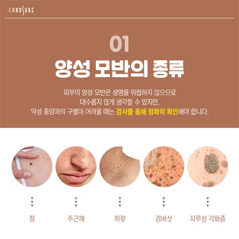 Cynosure Korea 흔히 볼 수 있는 피부의 점 🤔 양성모반은 생명을 위협하지 않으므로