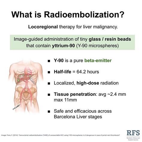 Y 90 Transarterial Radioembolization Is An Interventional Radiology