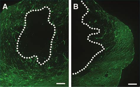 Lack Of Astrocyte Differentiation In The Graft At Day 30 Download Scientific Diagram