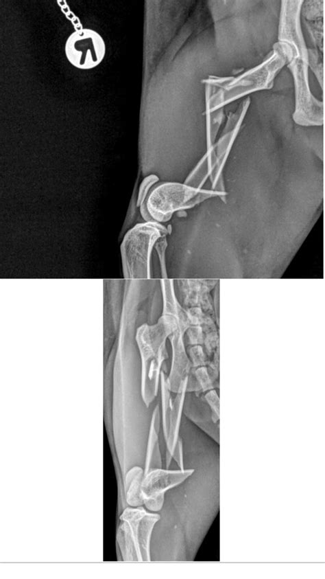 Greta Pavarotti On Linkedin Minimally Invasive Plate Osteosynthesis Mipo Technique 10 Comments