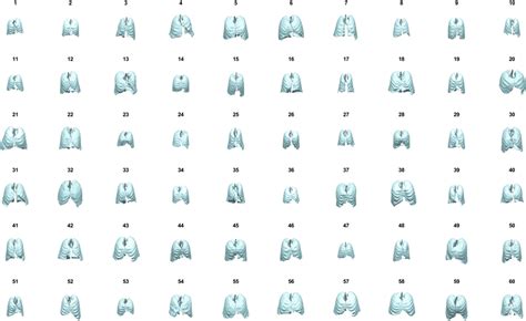 Some Of Segmented Lungs From CT Images Image Generated Using MATLAB