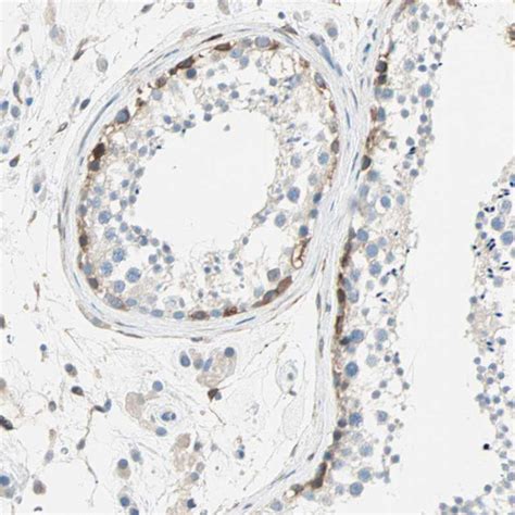 Rabbit Polyclonal Anti Atf6 Antibody Buy For Research Highly