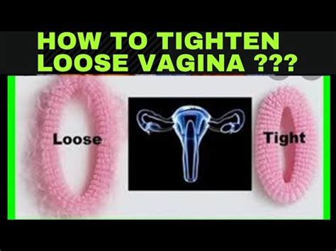 How To Tighten Loose Vagina After Delivery Vaginoplastydrraman