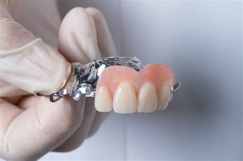 Different Types Of Partial Dentures From Which To Choose
