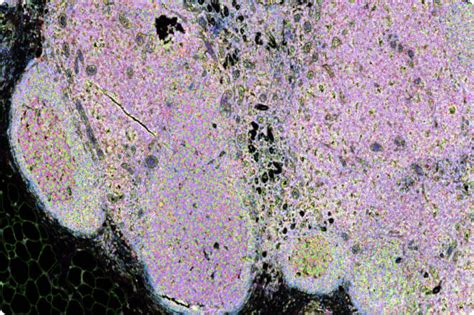 Xenium 5 000 Gene Panels 10x Genomics