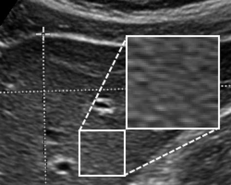Comparison Of Proposed Despeckling Techniques For Non Ultrasound Download Scientific Diagram