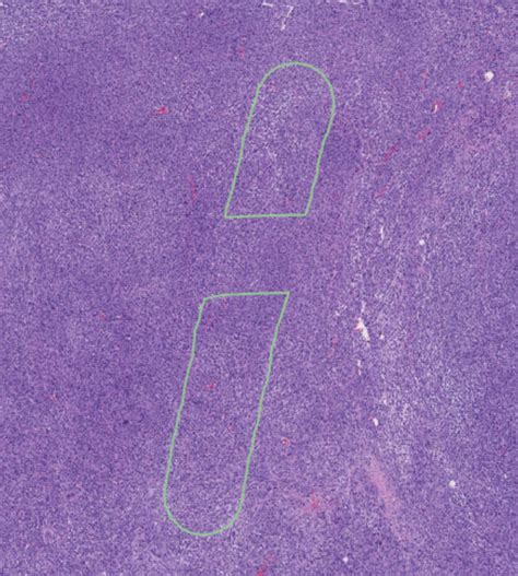 Remove Small Areas In A Big Annotation Usage And Issues Imagesc Forum