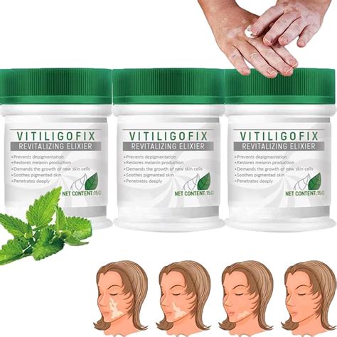 Vitiligo Fix Revitalize Elixir2023 Nueva Crema De Tratamiento De