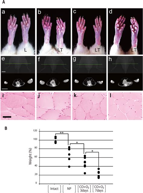 Muscle Evaluation In Transplanted Limbs At Postoperative Day 90 A