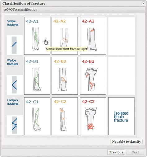 Classification Of Fracture After The Location And Side Of The Body