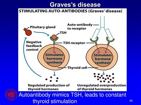 Tsh In Graves Disease Tsh Antibodies Disease Receptor Diagnosis