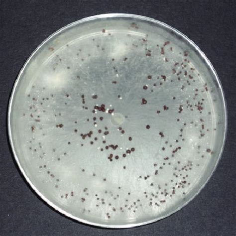 Culture Of Pythium Myriotylum On Potato Dextrose Agar Characterized By