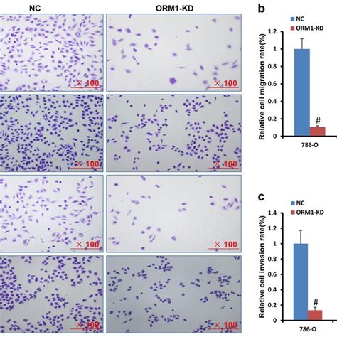 Orm1 Was Essential To Cell Migration And Invasion A Cell Migration