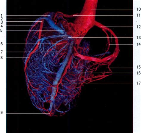 Ⅲ 22 心脏冠状动脉铸型下面观 C 介入治疗解剖学 医学