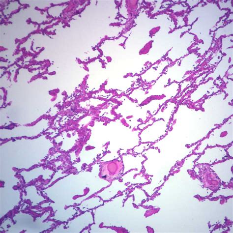 Lung Microscope Slide Labeled At Penny Troche Blog