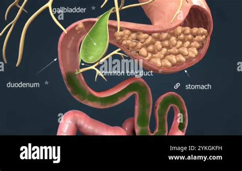Gallbladder Function In Digestion Stock Videos And Footage Hd And 4k Video Clips Alamy