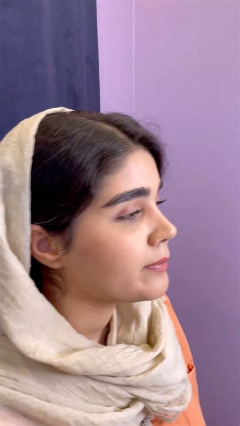 ‎دکتر سمیه طریقت‎ ‎نیوشا جون هشت ماه بعد از جراحی بینی گوشتی😍👌 لطفا