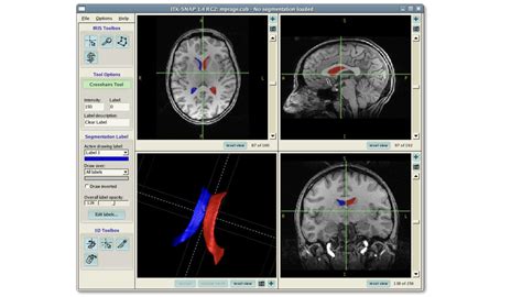 Best Dicom Annotation Platform In 2025 — Radiology Grade Secure And Fast