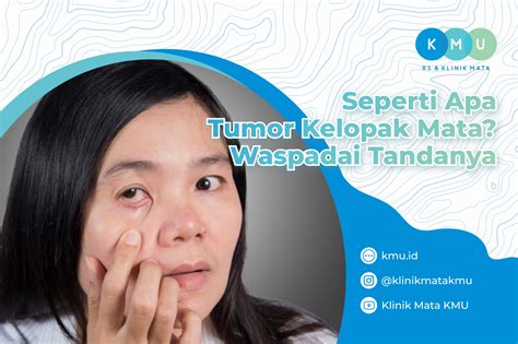 Seperti Apa Tumor Kelopak Mata Waspadai Tandanya