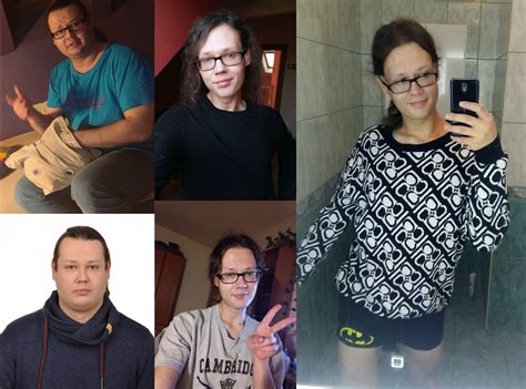 May 21 October 22 Mtf Non Binary 30 Years Old No Hrt Yet But I