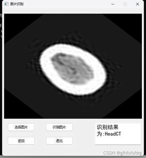 0073期通过cnn卷积网络识别ct图 含数据集cnn识别轮廓 Ct图像 Csdn博客