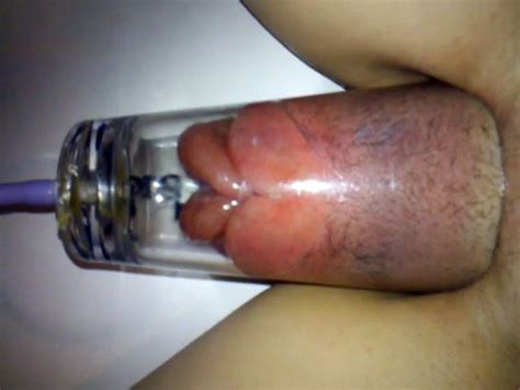 Girls Extreme Pussy Pumping Bizarre Porn At ThisVid Tube Girls Extreme Pussy Pumping Bizarre Porn At ThisVid Tube