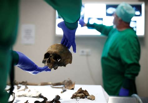 Exhumed Bodies Can Still Reveal Vital Evidence Says Forensic Expert