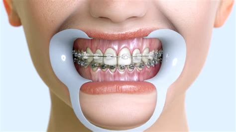11200 Animated Teeth Stock Videos And Royalty Free Footage Istock