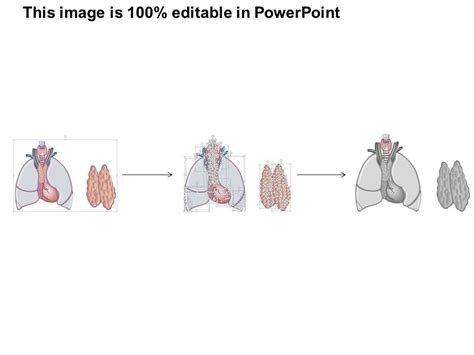 Thymus Gland Medical Images For PowerPoint PowerPoint Presentation Images Templates PPT